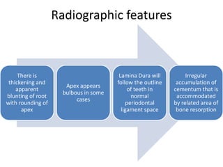 21.hypercementosis | PPTX