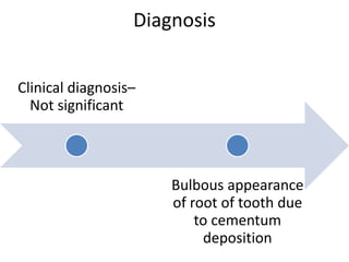 21.hypercementosis | PPTX