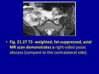 21 DAVID SUTTON PICTURES THE LARGE BOWEL | PPT