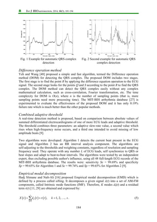 QRS Complex Detection and Analysis of Cardiovascular Abnormalities: A Review | PDF | Heart and ...