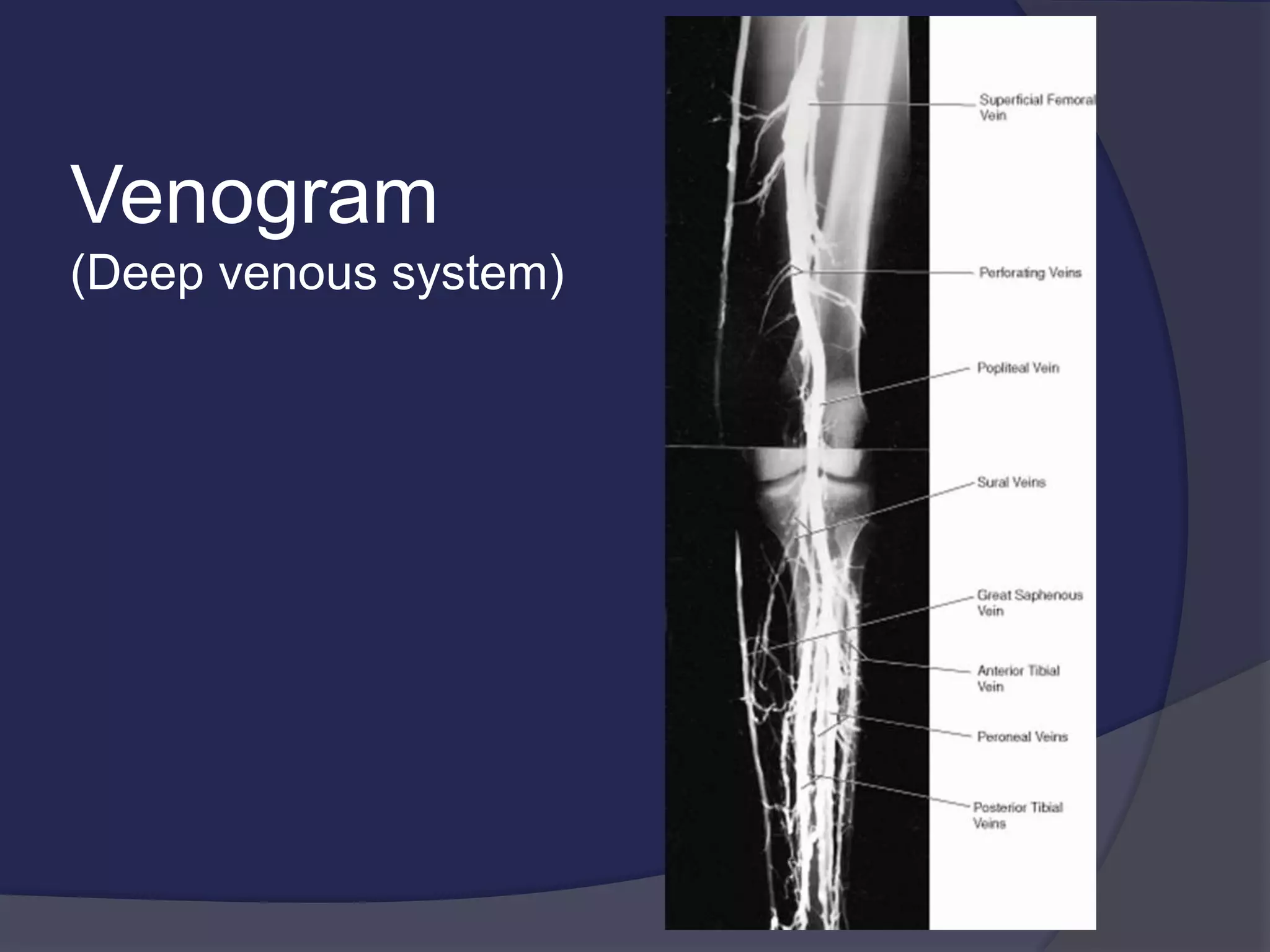 venous drainage of the lower limb | PPTX