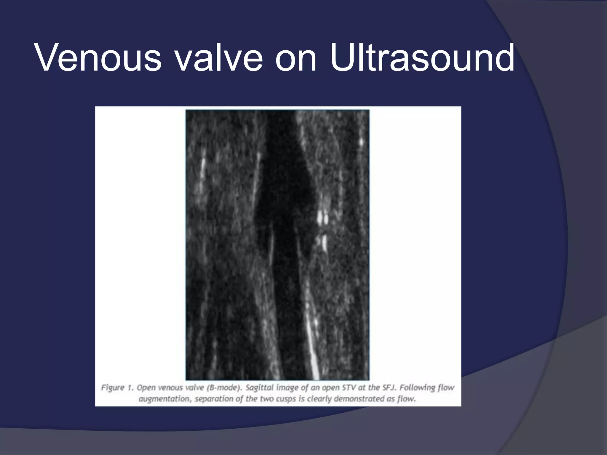 venous drainage of the lower limb | PPTX