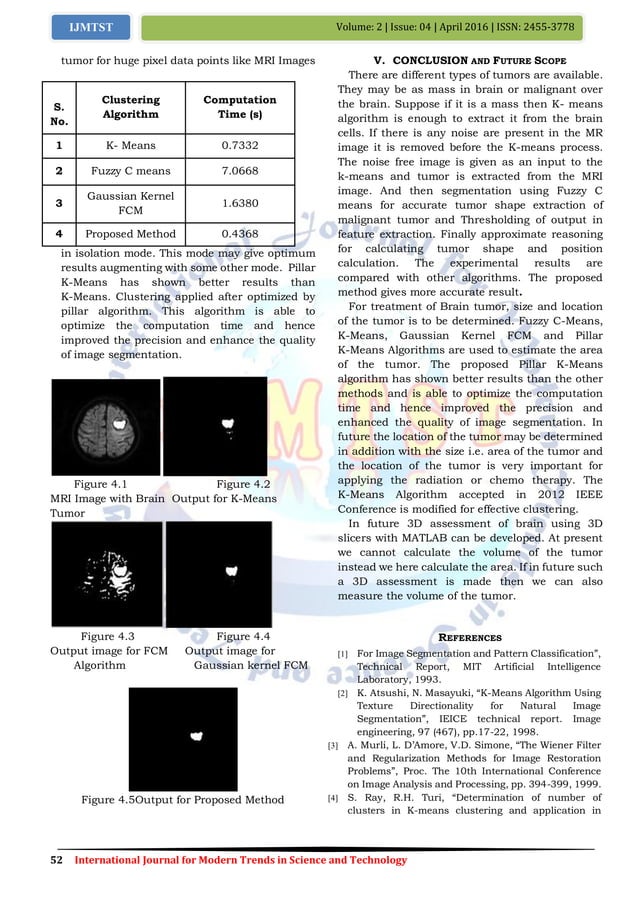 Comparison Of Image Segmentation Algorithms For Brain Tumor Detection 5706