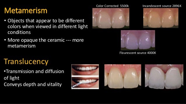 COLOR OF NATURAL TEETH