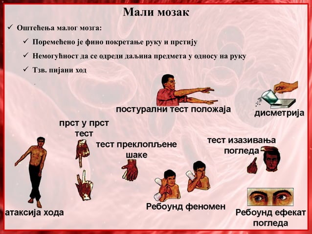 21. Mali mozak i medjumozak | PPTX