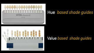 Color of Natural Teeth and shade selection in dentistry. | PPTX