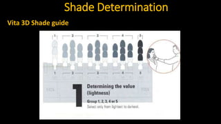 Color of Natural Teeth and shade selection in dentistry. | PPTX