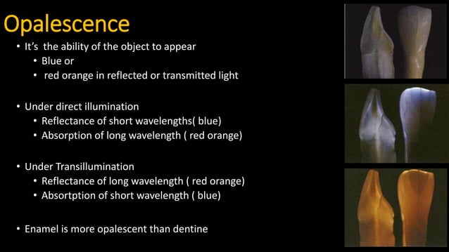 Color of Natural Teeth and shade selection in dentistry. | PPT