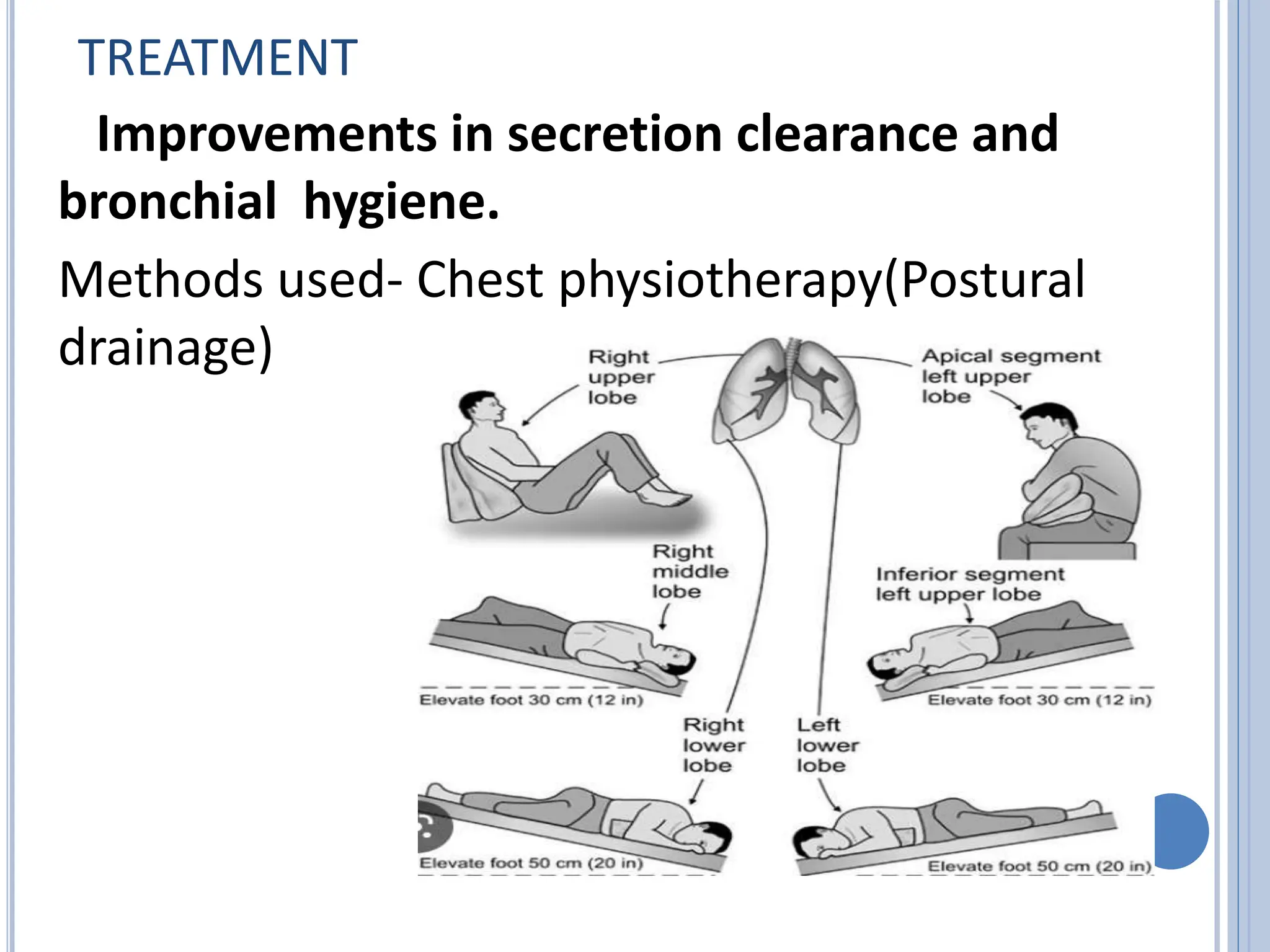 21.BRONCHIECTASIS.pptx mbbss respiratory | PPTX