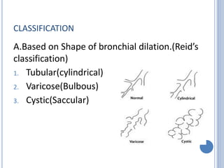 21.BRONCHIECTASIS.pptx mbbss respiratory | PPTX