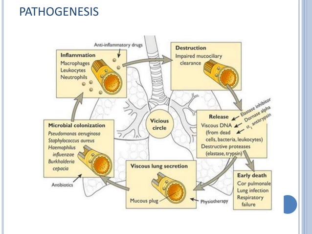 21.BRONCHIECTASIS.pptx mbbss respiratory | PPT