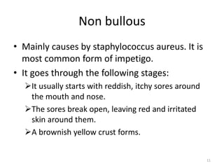Neonatal Impetigo for Paediatrics and Neonates | PPTX