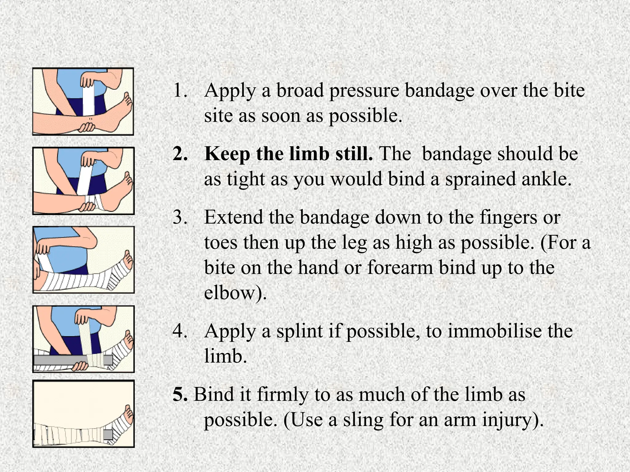21.GIGITAN ULAR dan pencegahannya(SNAKE BITE).ppt