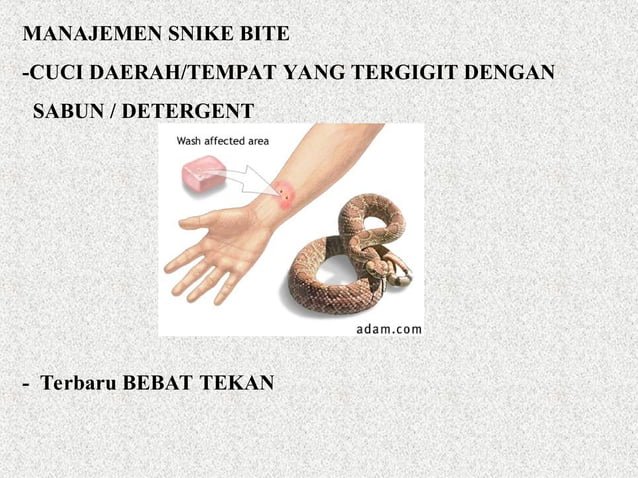 21.GIGITAN ULAR dan pencegahannya(SNAKE BITE).ppt