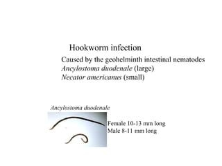 21-Hookworms parasitology presentation ppt | PPT