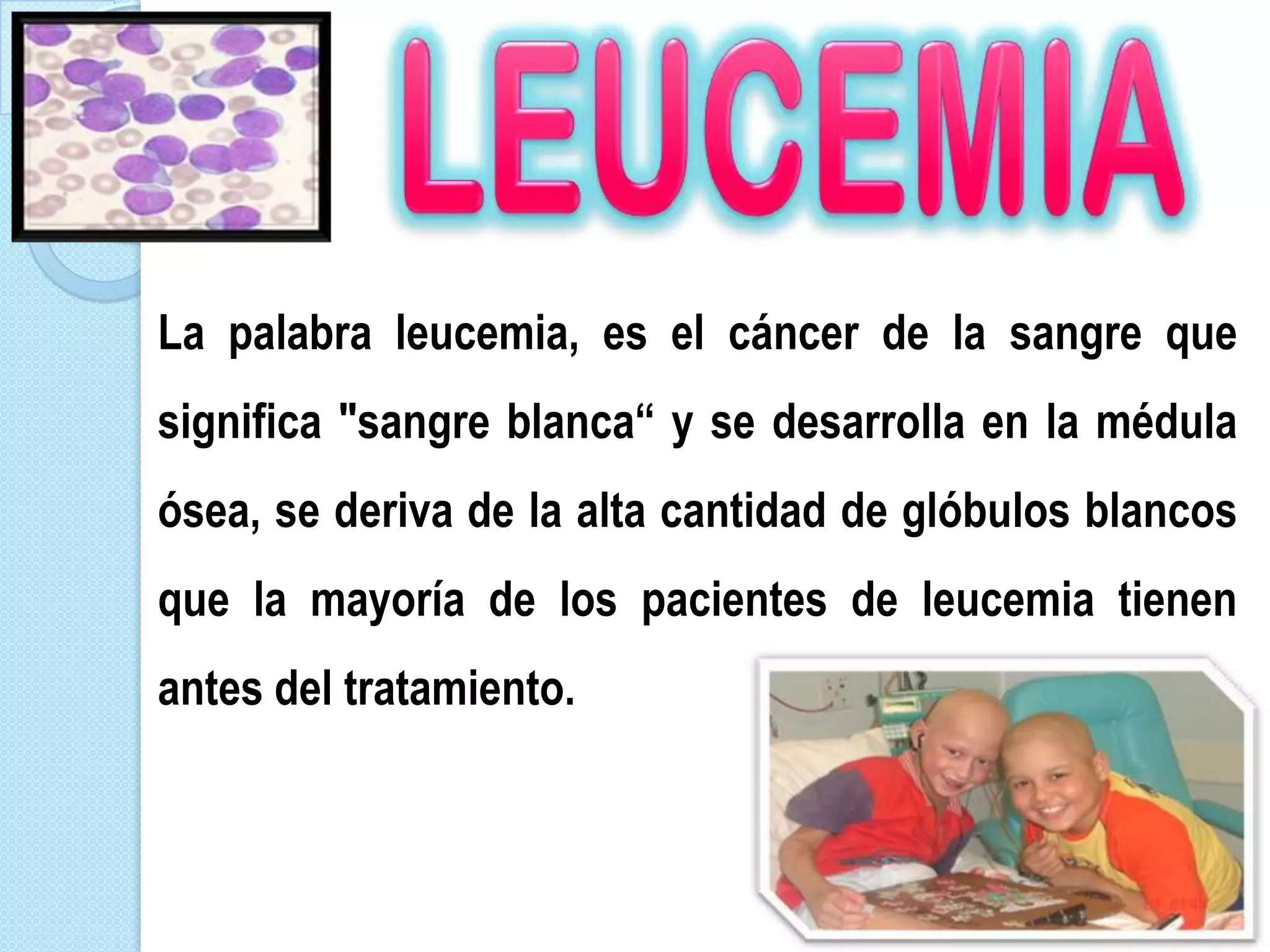 21. leucemia... yubicela | PPTX | Blood Disorders | Diseases and Conditions