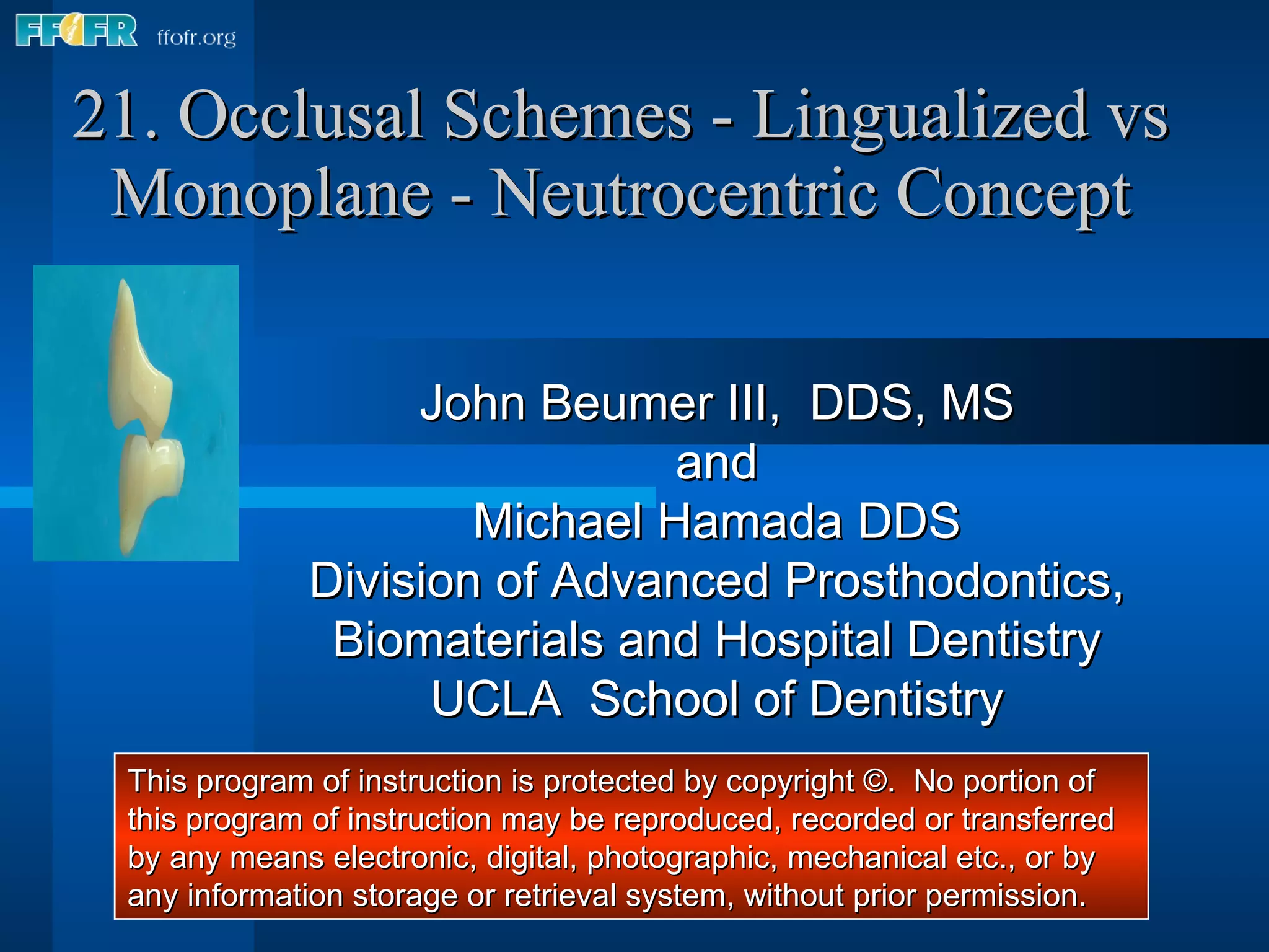 21.occlusal schemes monoplane with balancing ramps | PPT