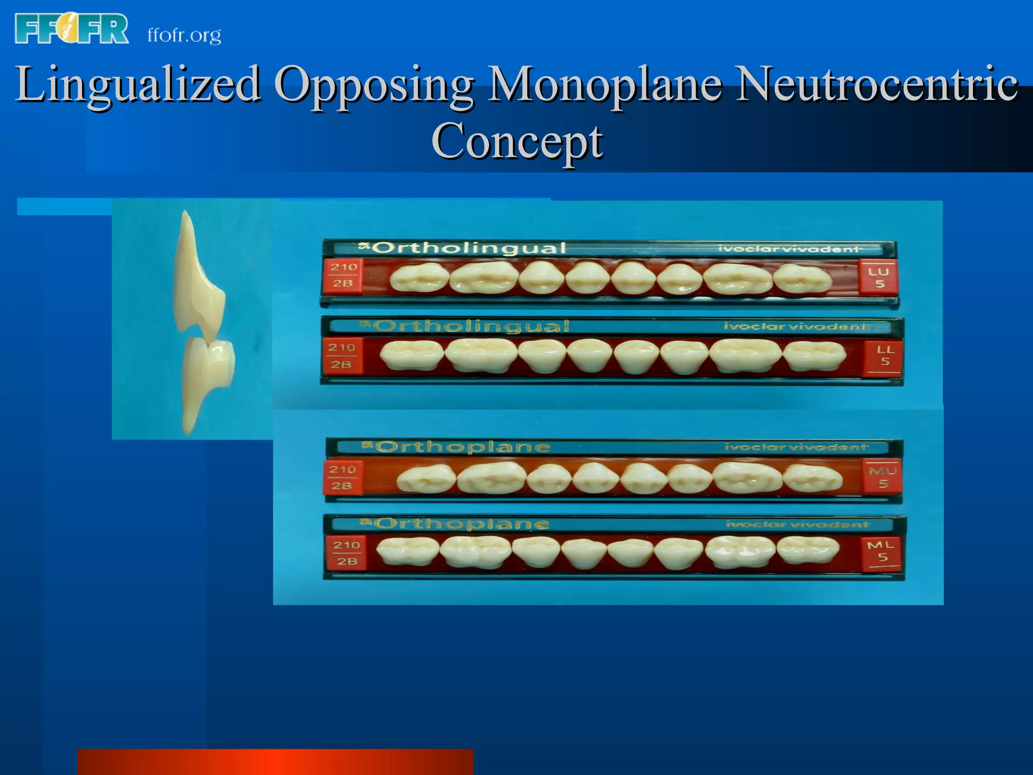 21.occlusal schemes monoplane with balancing ramps | PPT
