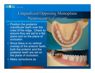 21.occlusal schemes monoplane with balancing ramps | PDF