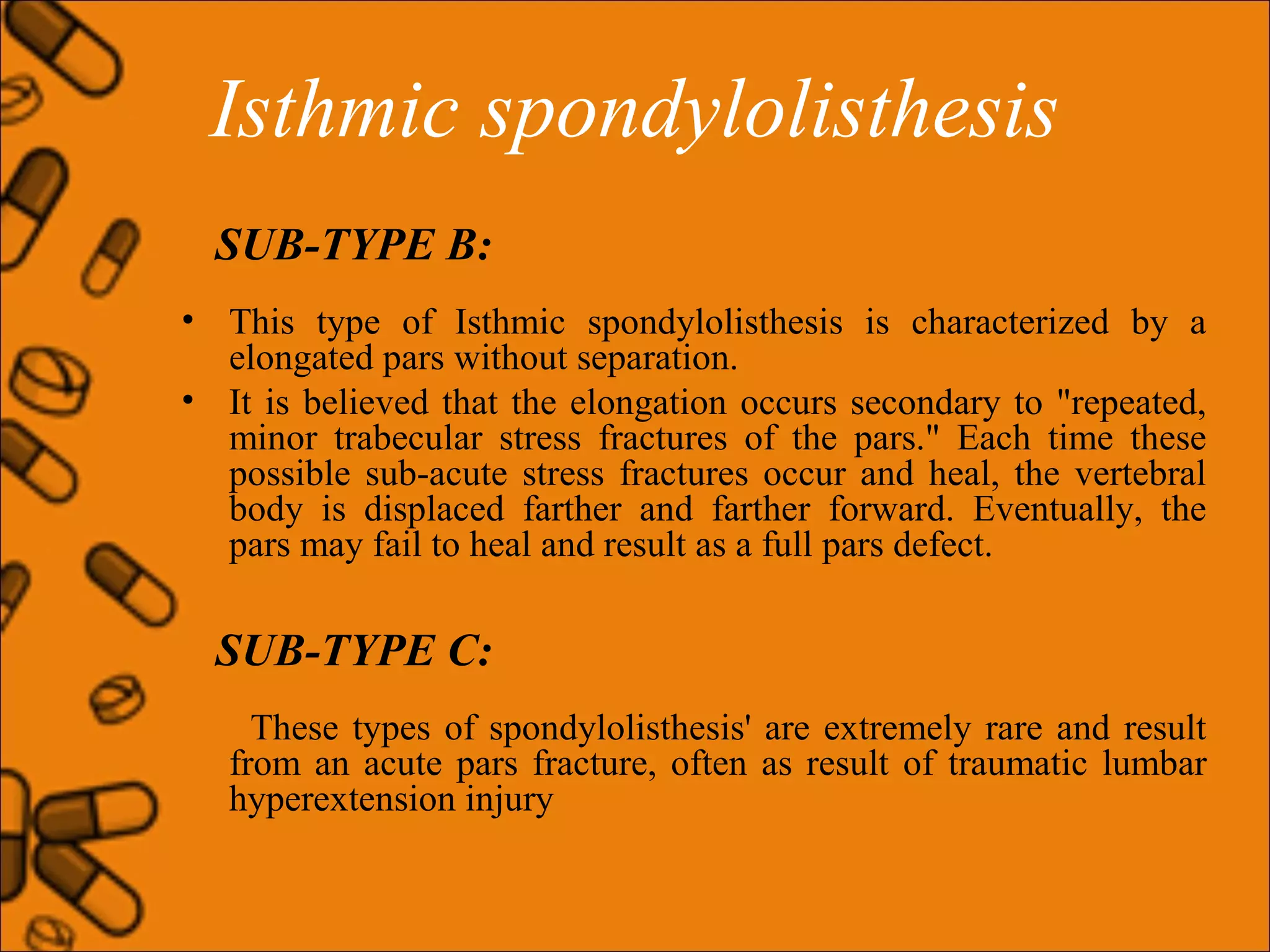 spondylolisthesis | PPT