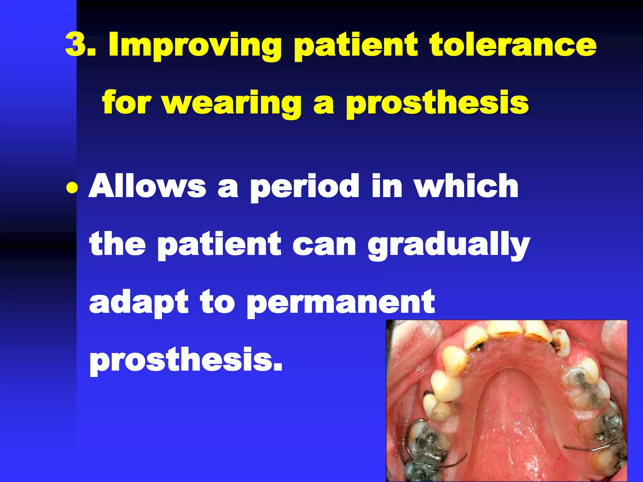 Temporary removable partial dentures | PPT