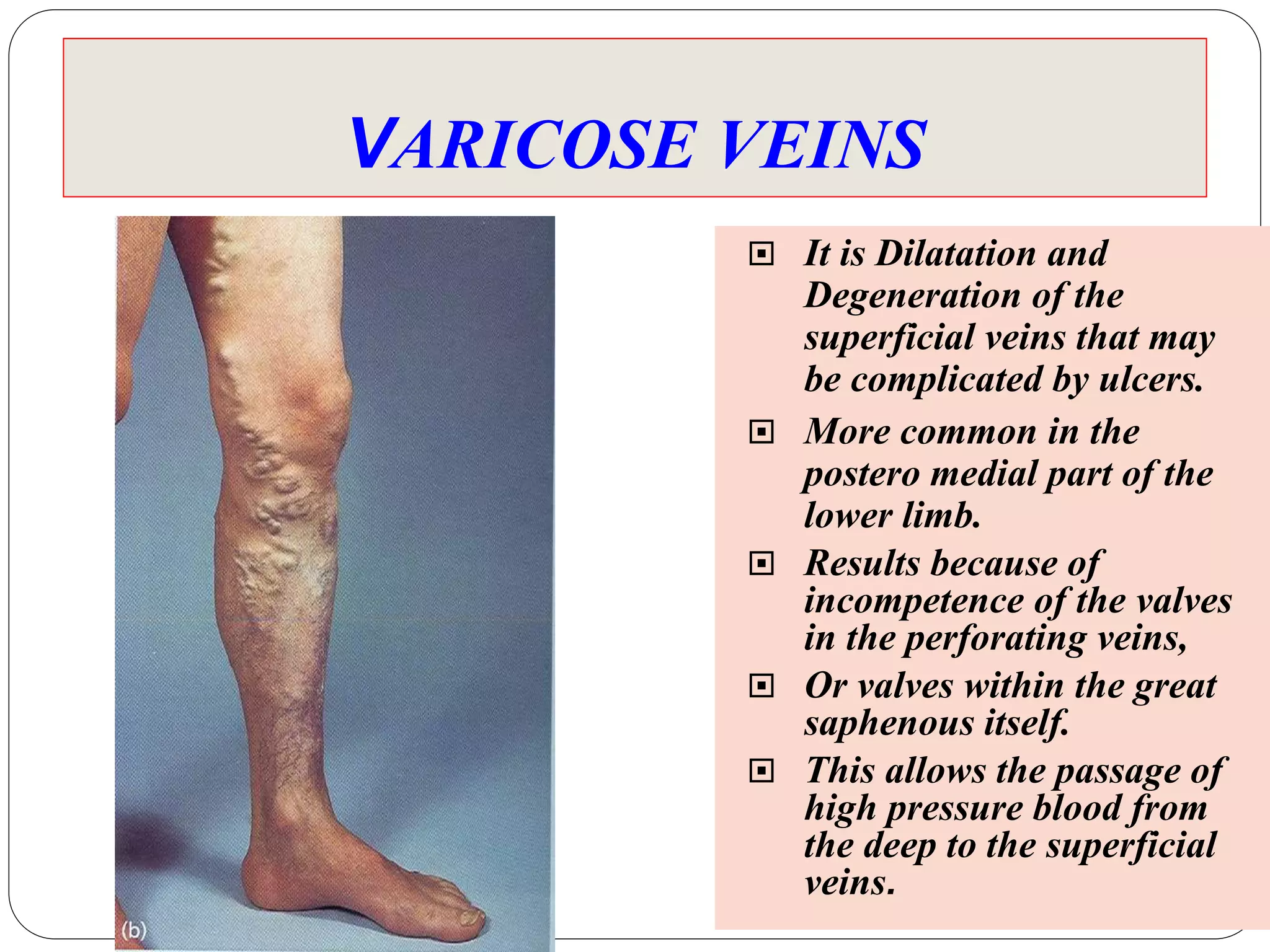 21-Vascular anatomy of the lower limb.pptx