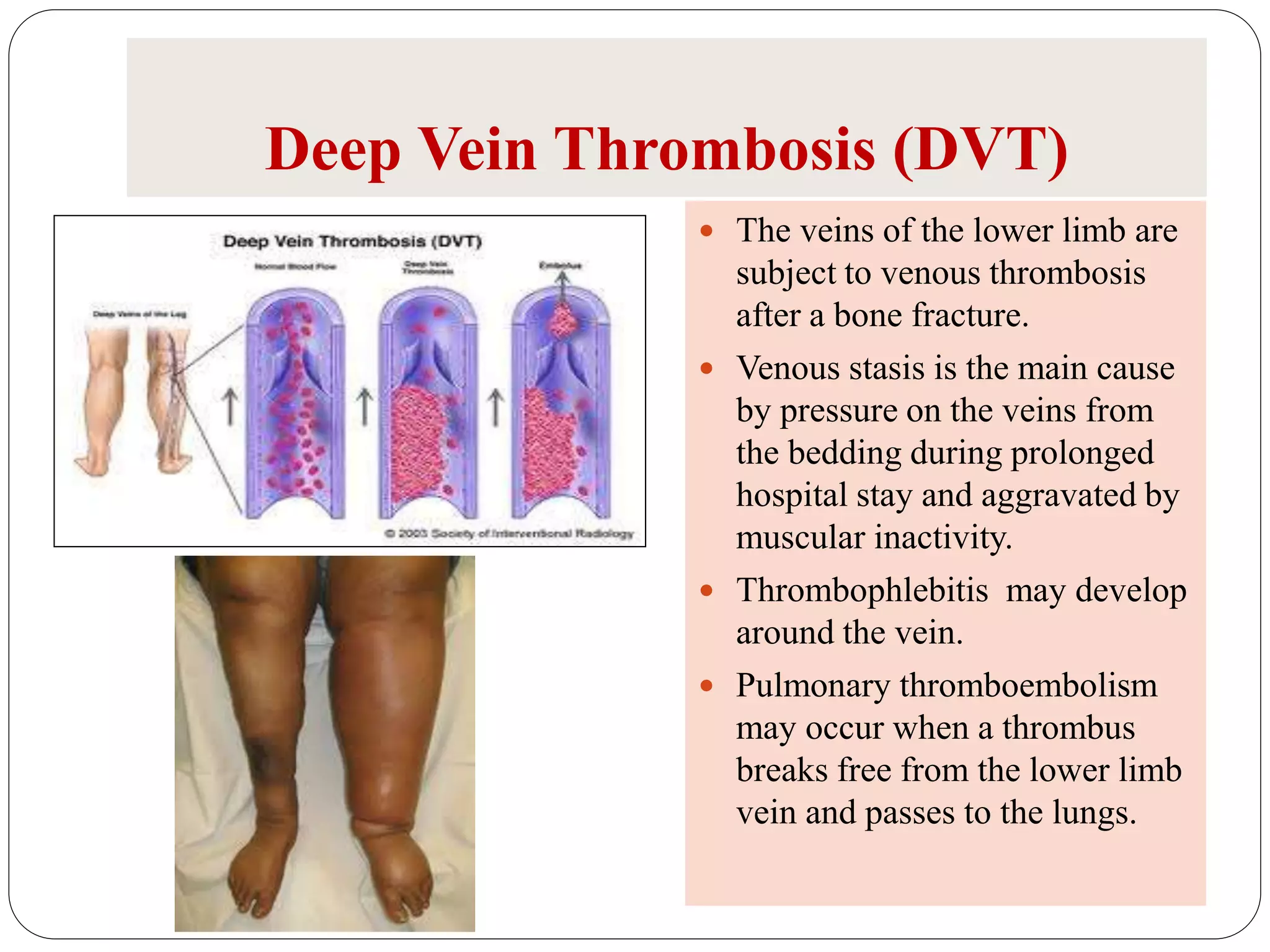 21-Vascular anatomy of the lower limb.pptx