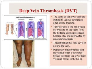 21-Vascular anatomy of the lower limb.pptx