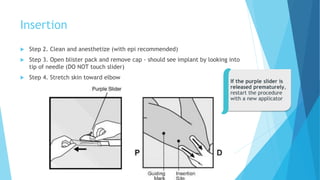 210126-Implant-Insertion-and-removal.pptx