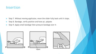 210126-Implant-Insertion-and-removal.pptx