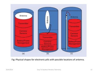 easy to way swallow wireless telemetry | PPTX