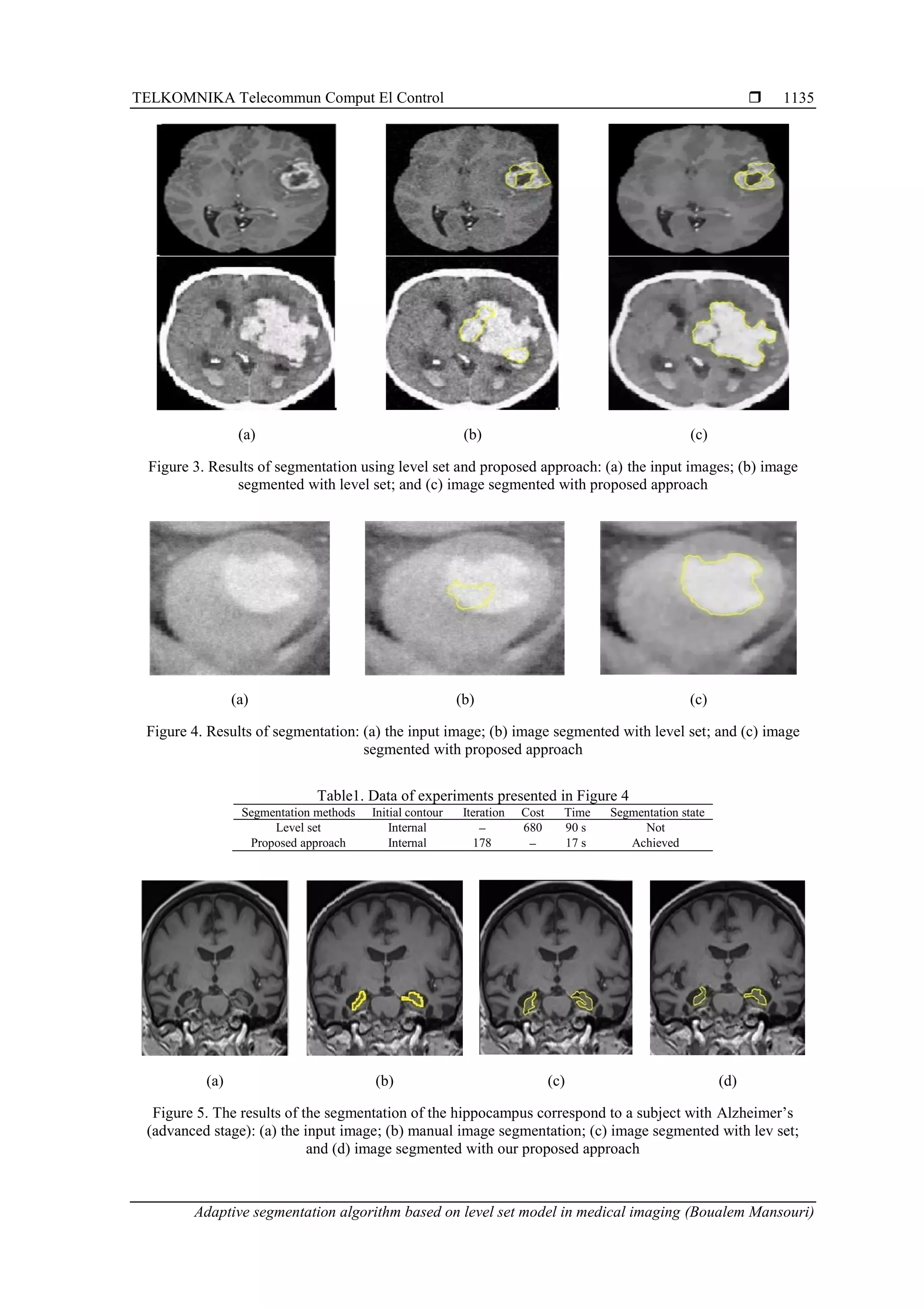 Adaptive Segmentation Algorithm Based On Level Set Model In Medical