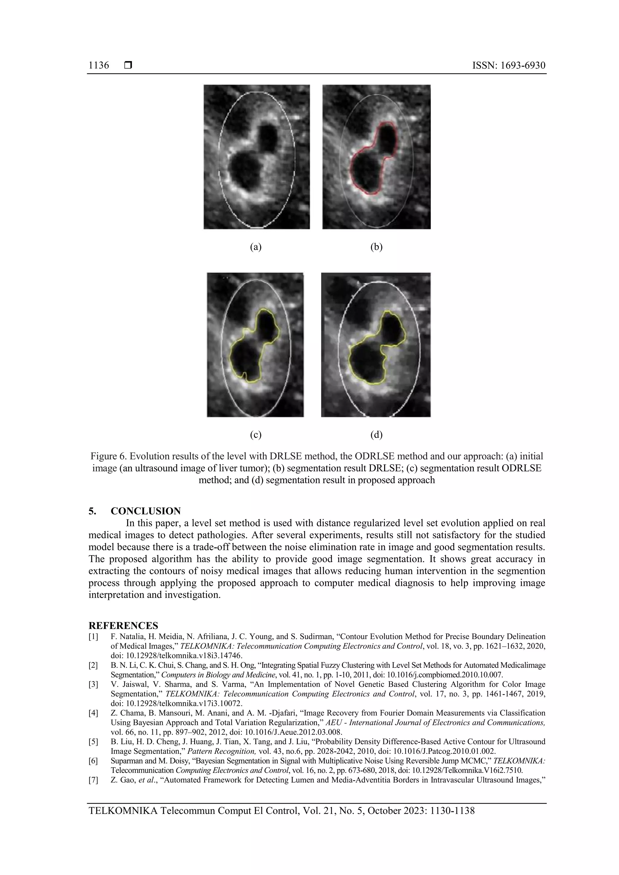 Adaptive Segmentation Algorithm Based On Level Set Model In Medical