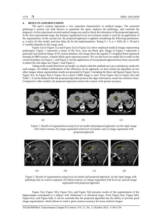 Adaptive segmentation algorithm based on level set model in medical imaging | PDF | 3-D Graphics ...