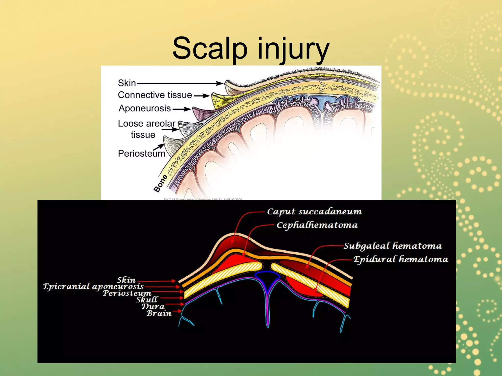 212 Birth head trauma | PPT