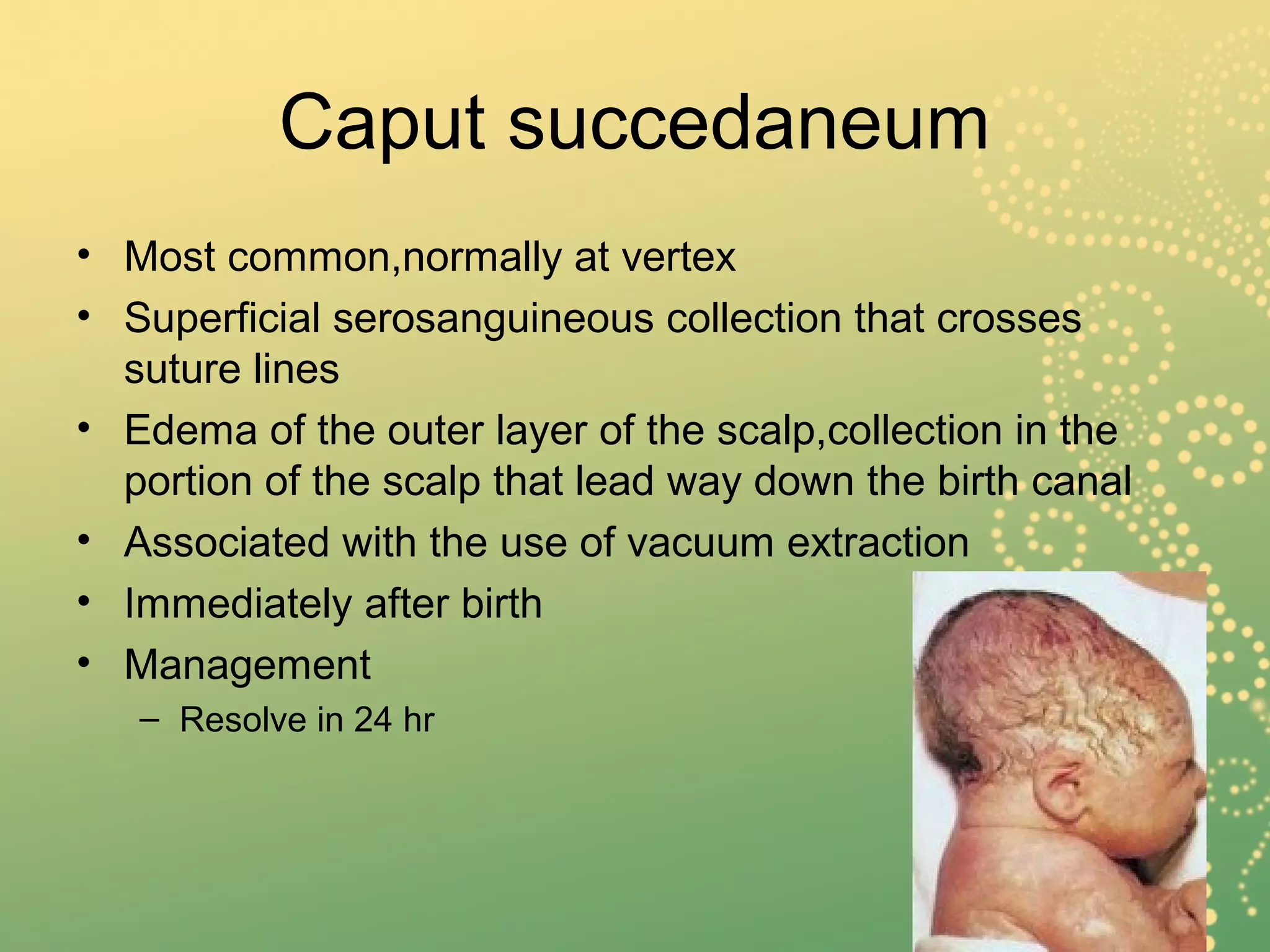 212 Birth head trauma | PPT