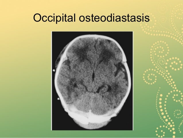 212 Birth head trauma