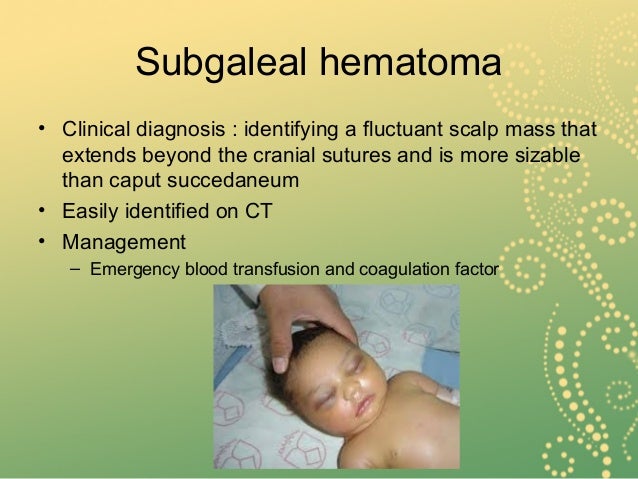 212 Birth head trauma