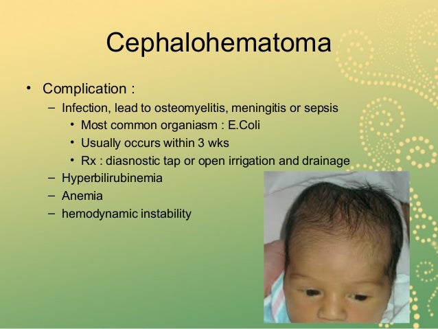 212 Birth head trauma