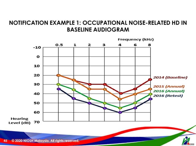 Audiometric Testing and Analysis Occupational Health Disease | PDF