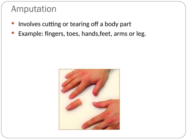 213095393-Types-of-Wounds for orthopedicand TraumaMedicinestudents.ppt