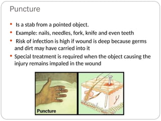 213095393-Types-of-Wounds for orthopedicand TraumaMedicinestudents.ppt