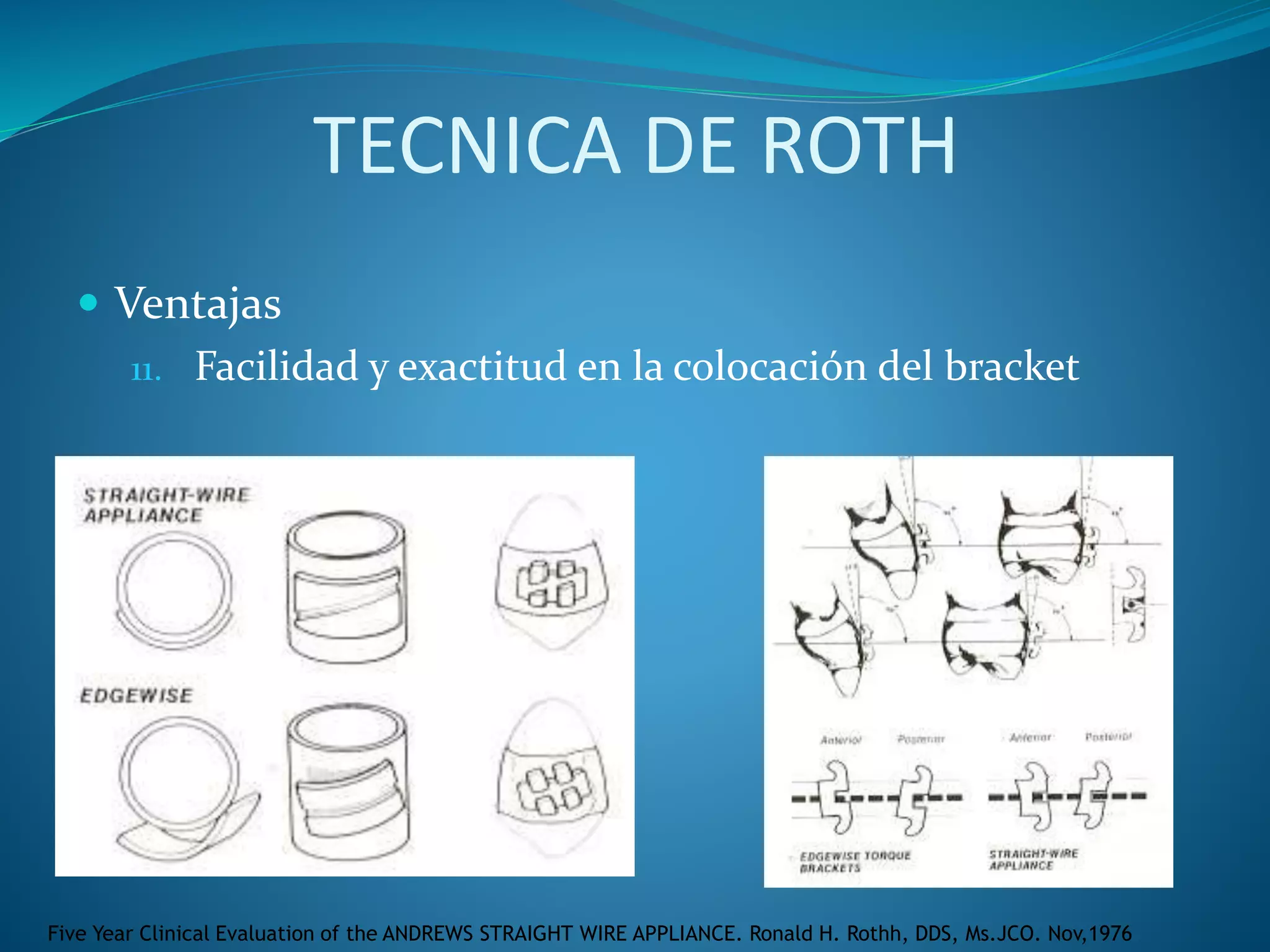 213736064-Tecnica-de-Roth-Presentacion.pptx