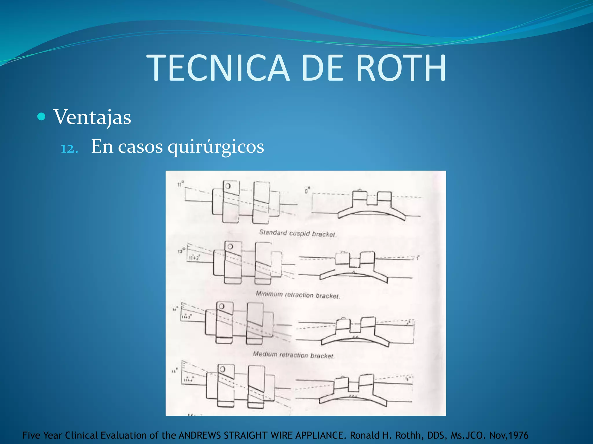 213736064-Tecnica-de-Roth-Presentacion.pptx