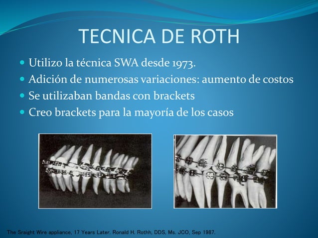 213736064-Tecnica-de-Roth-Presentacion.pptx
