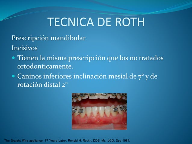 213736064-Tecnica-de-Roth-Presentacion.pptx
