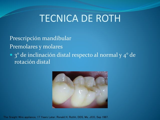 213736064-Tecnica-de-Roth-Presentacion.pptx