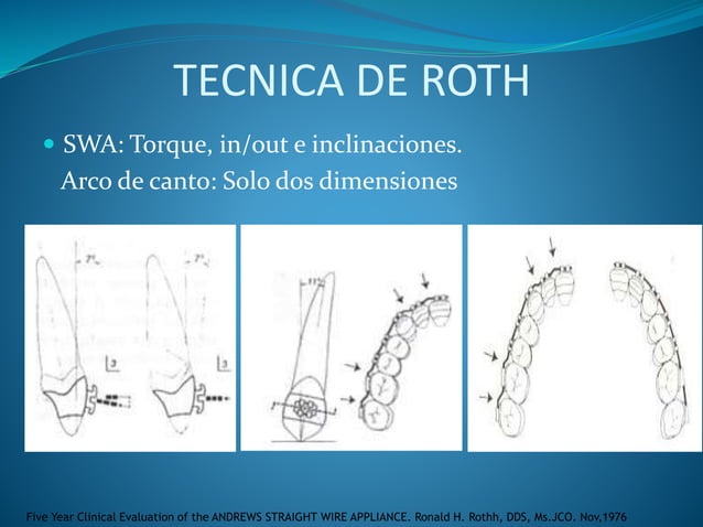 213736064-Tecnica-de-Roth-Presentacion.pptx