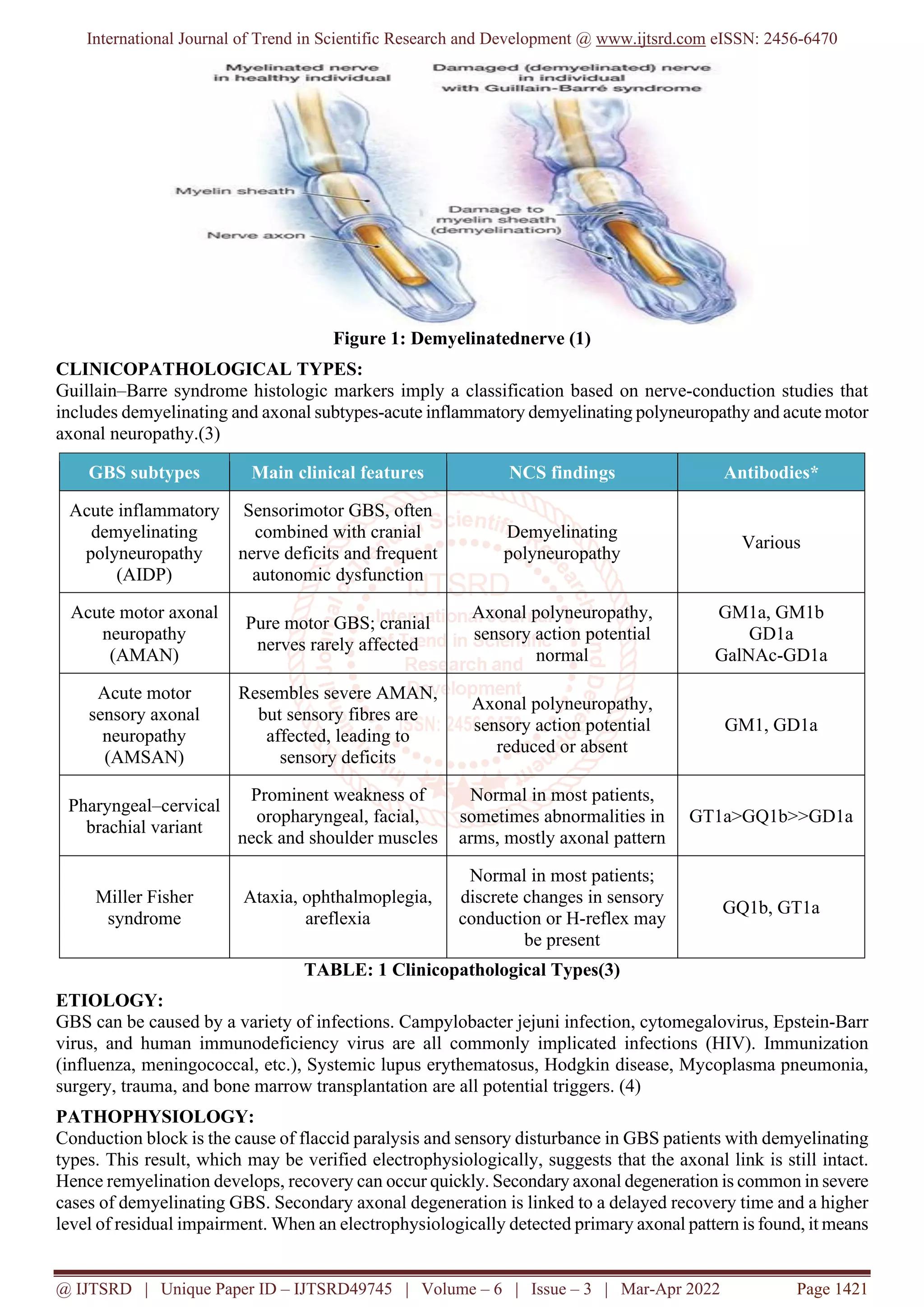 Guillain Barre Syndrome A Review | PDF