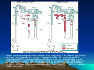 acute kidney injury lecture for student.pptx